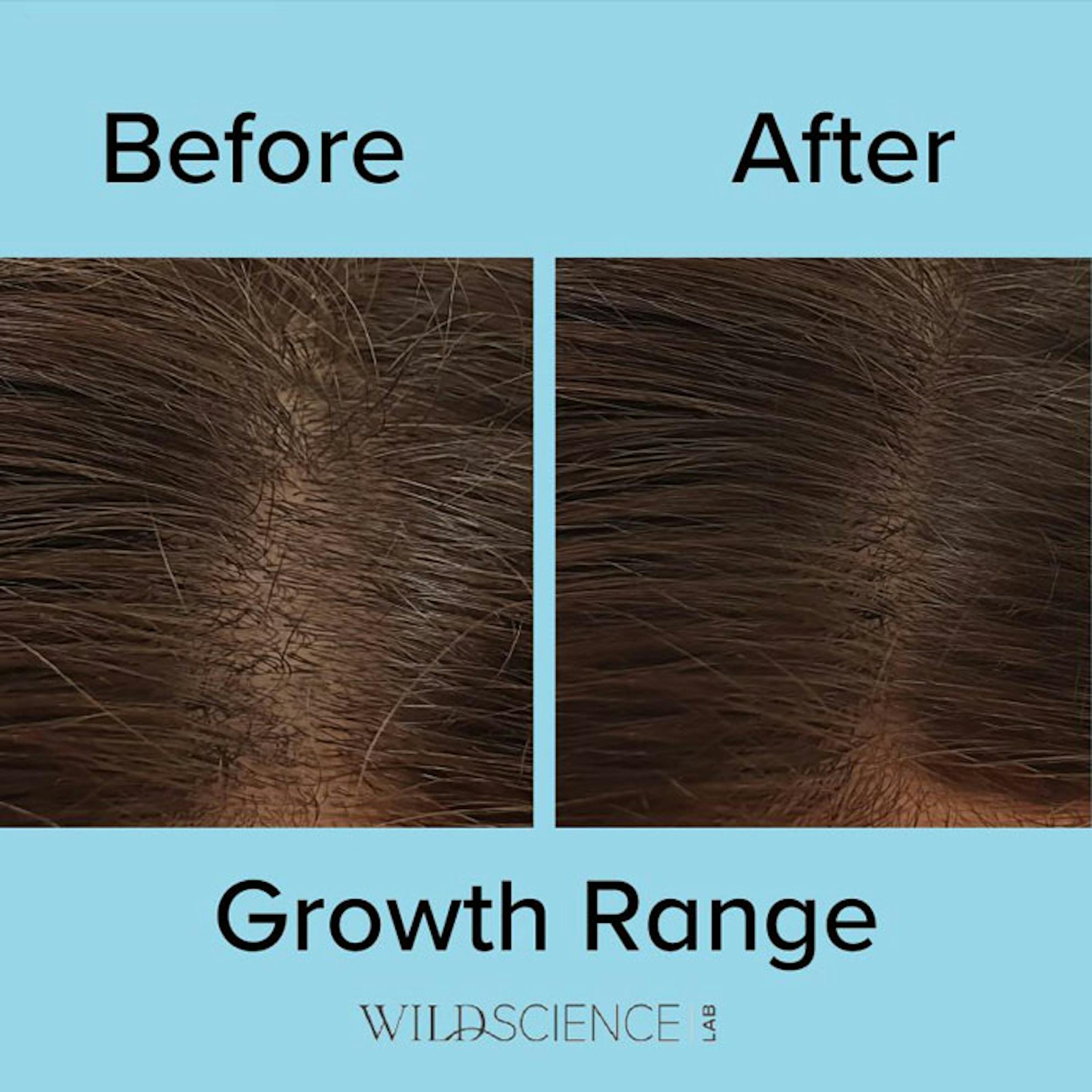 Wild Science Growth Boost Thickening Shampoo 265ml | The Fragrance Shop